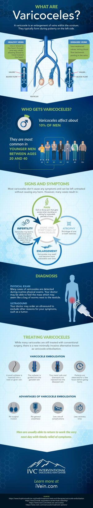 Varicocele Treatment | IVC