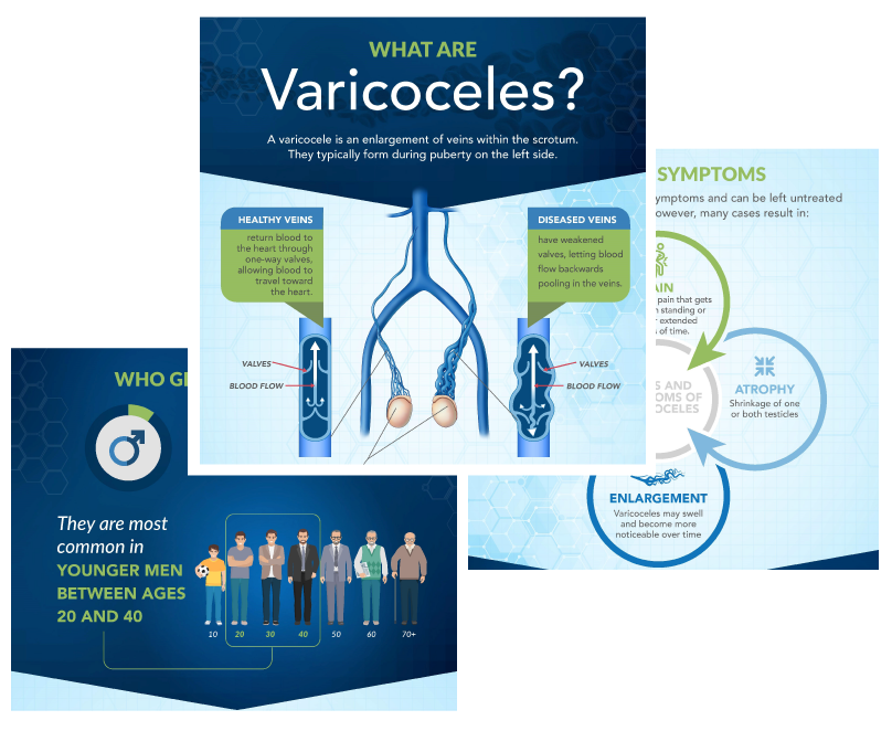 Varicocele Treatment | IVC