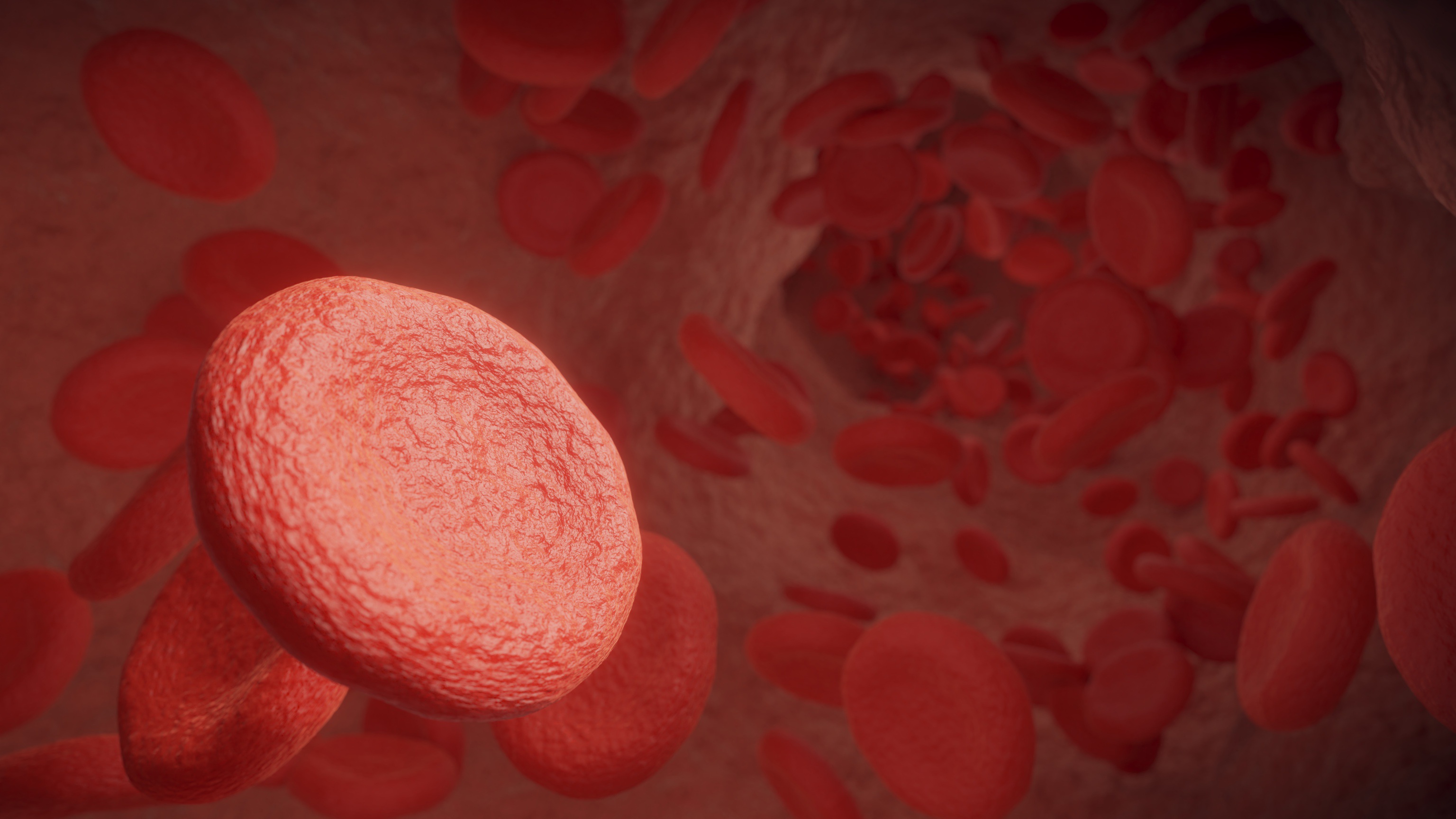 What is deep vein thrombosis (DVT)? | IVC Interventional Vascular and ...